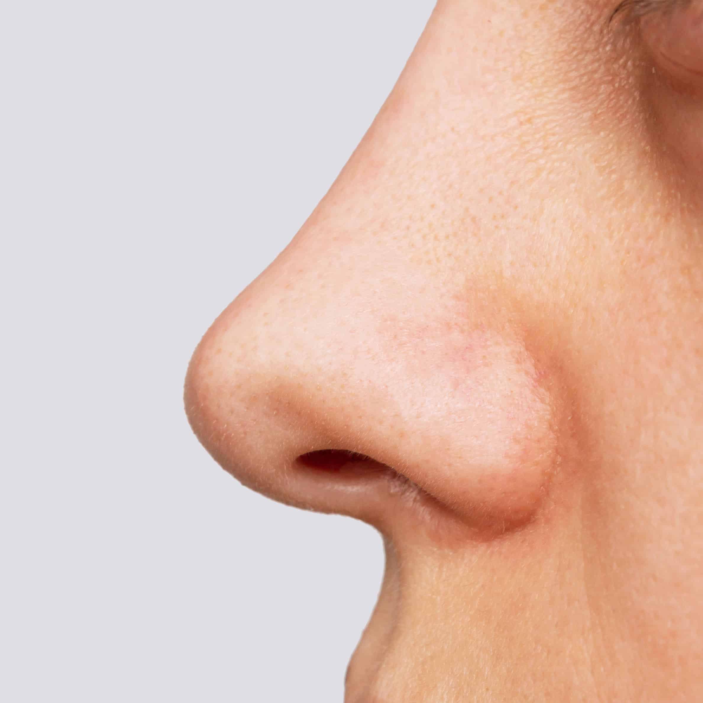 Calibrated noses - SRL Technical Services